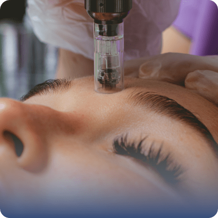 RevitalEyes Med Spa in Alliston Ontario
